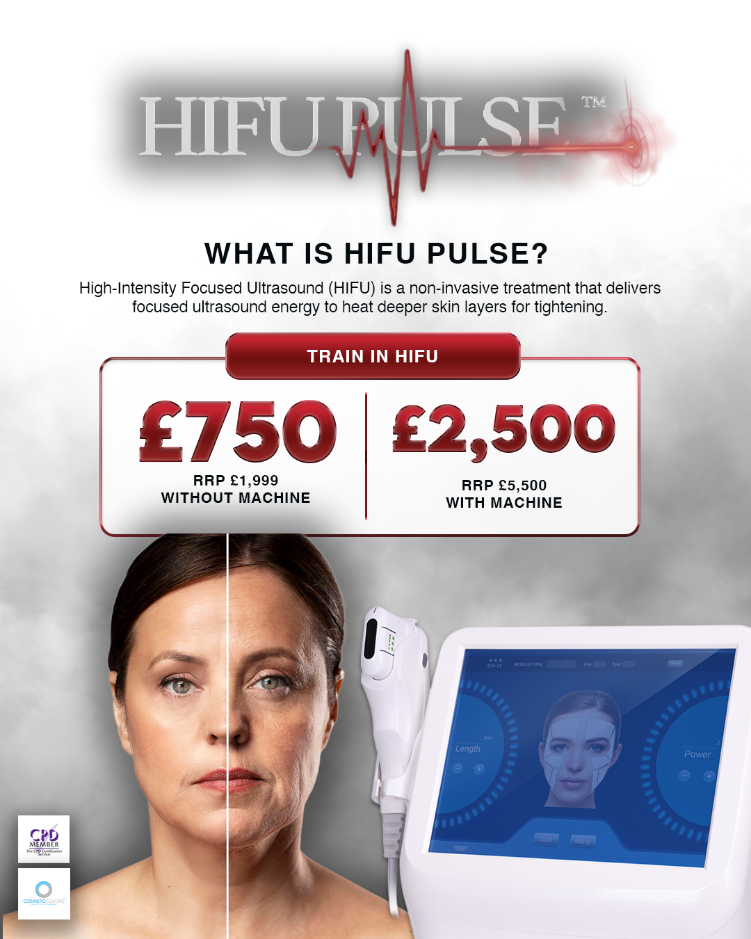 HIFU Pulse Machine + Training Package – Pulse Technology Supplies